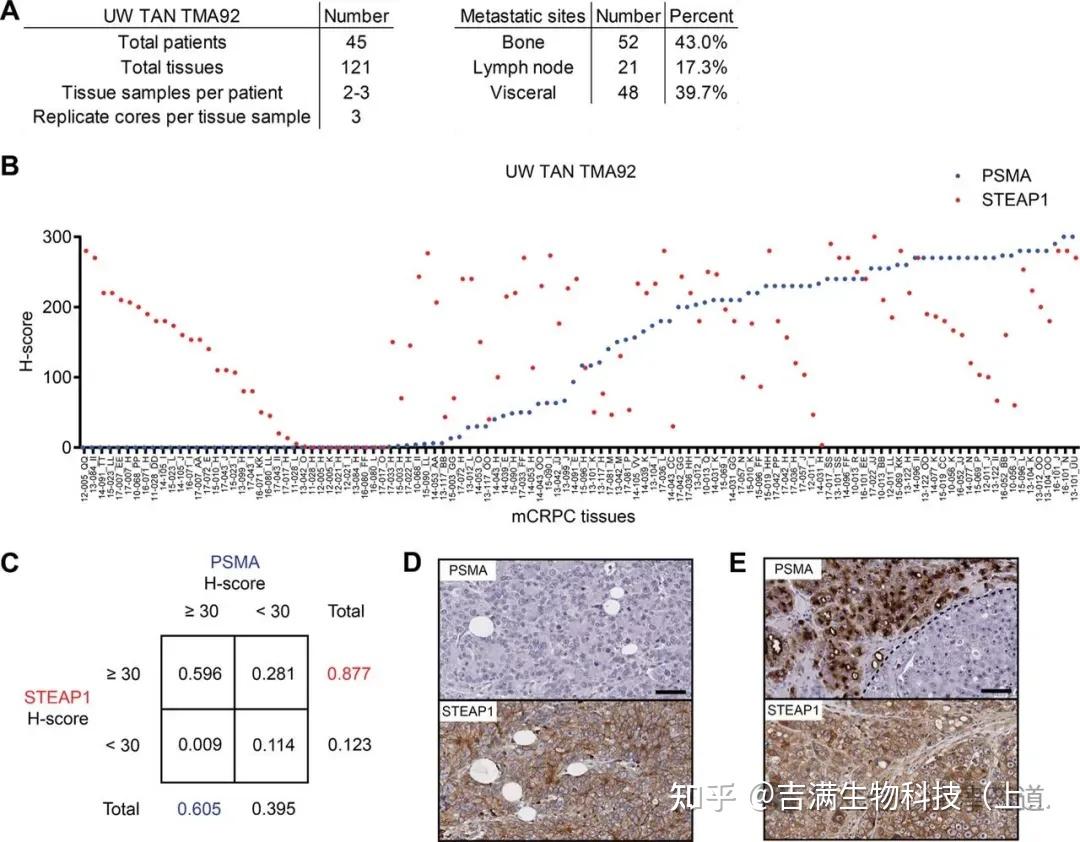 前列腺癌靶向治疗的热门靶点：STEAP1 - 知乎