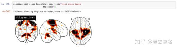 nilearn 笔记（5） - 知乎