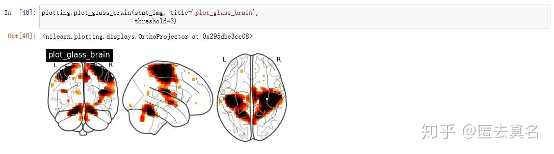 nilearn 笔记（5） - 知乎
