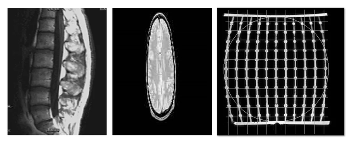 MRI梯度性能参数辨析 - 知乎