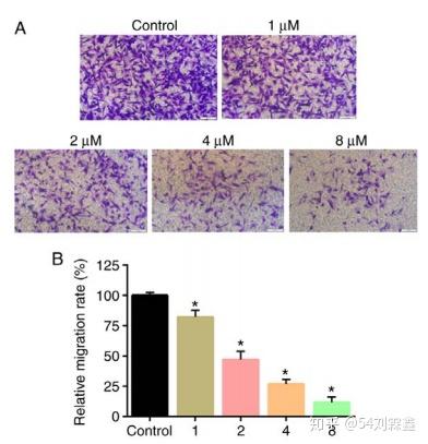 Transwell实验---从入门了解到SCI写作 - 知乎