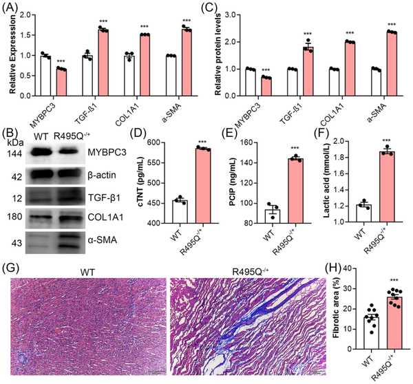 文献解读 | 通过基因编辑猪探索心肌纤维化发病机制！ - 知乎