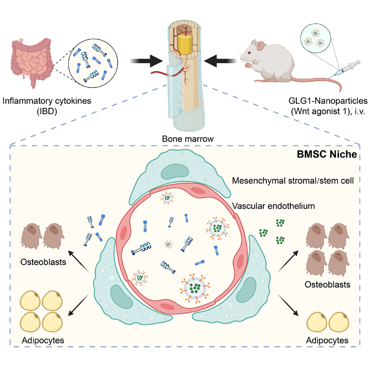Cell Rep Med｜苏佳灿/徐灿/陈晓团队合作揭秘炎症性肠病骨丢失机制 - 知乎