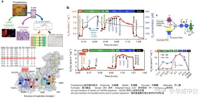 Nature子刊 | 高级别前列腺癌中的 OXPHOS 重塑涉及 mtDNA 突变和琥珀酸氧化增加 - 知乎