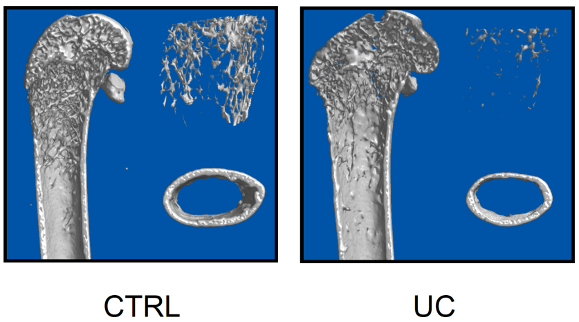 Cell Rep Med｜苏佳灿/徐灿/陈晓团队合作揭秘炎症性肠病骨丢失机制 - 知乎
