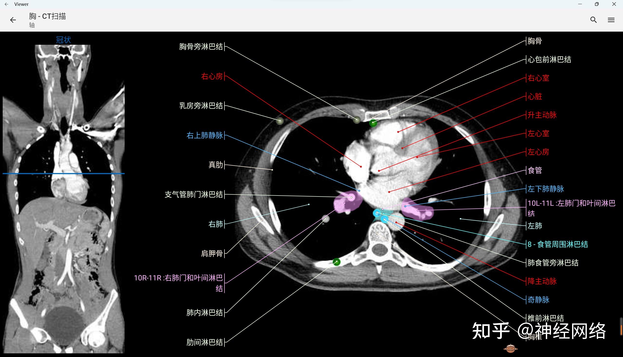 推荐一款超实用的影像软件工具 e-Anatomy（支持安卓、win11及Mac设备） - 知乎