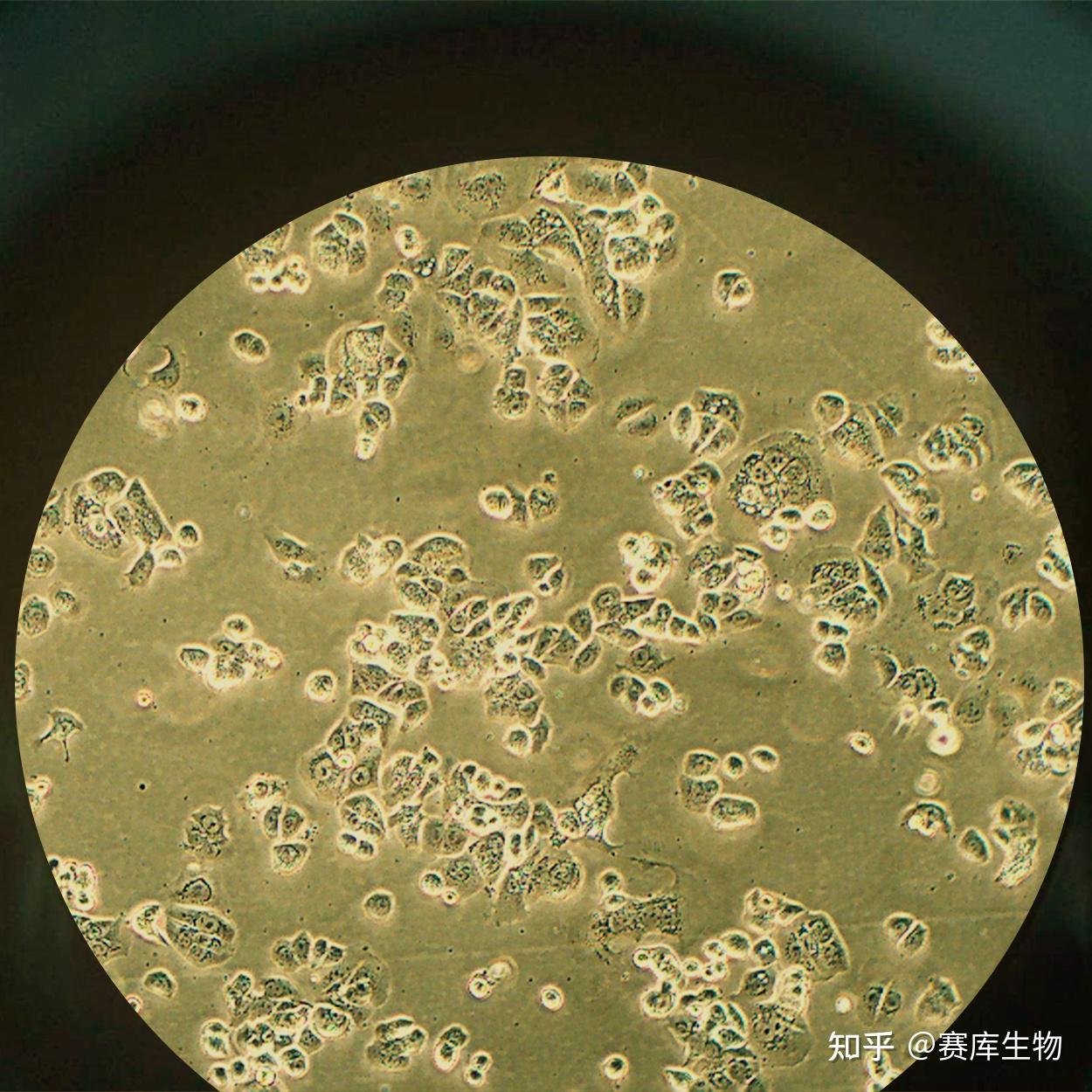 细胞学堂|SK-BR-3人乳腺癌细胞的生长特性及常见问题 - 知乎