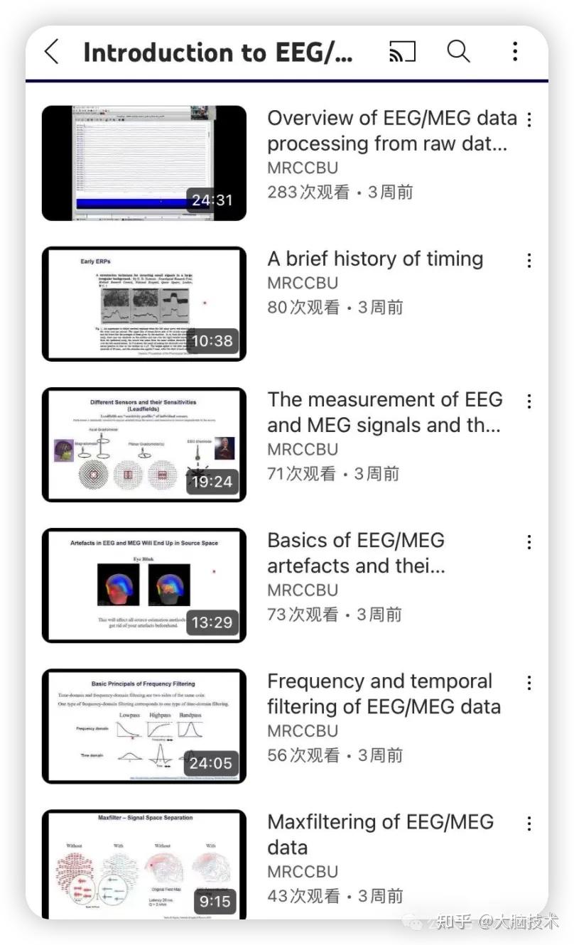 脑电/脑磁 （EEG/MEG） 教学视频——来源剑桥大学Dr.Olaf Hauk - 知乎