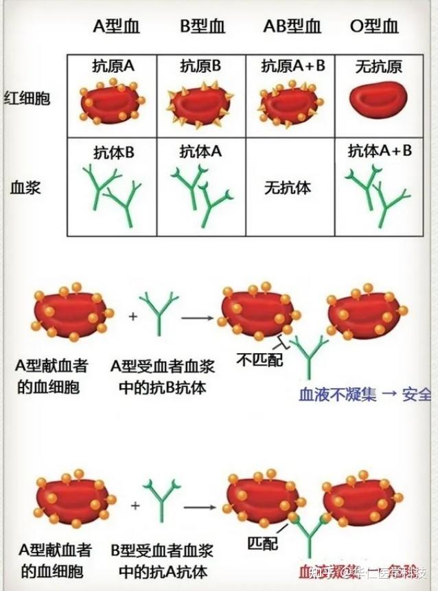 器官移植新进展！通用血型器官有望解决配型难题 - 知乎
