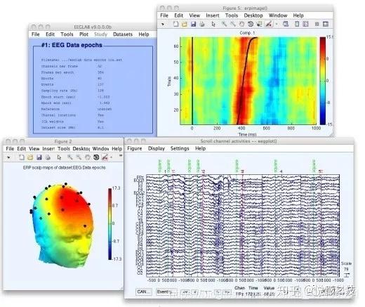 EEG信号处理与分析常用工具包介绍 - 知乎