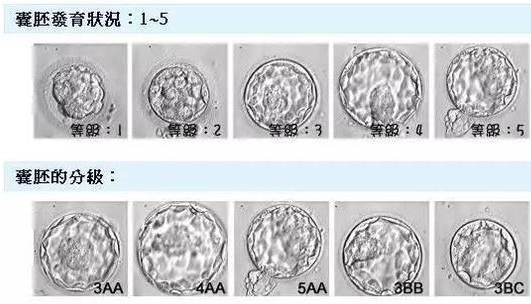 3BB是什么意思？带您走进胚胎质量评估 - 知乎