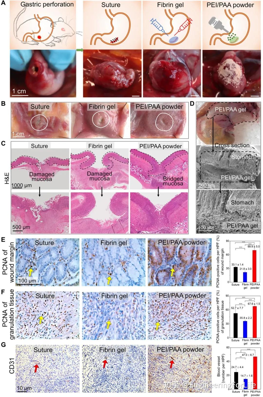 Science Advances: 超快自凝胶粉促进胃肠道穿孔愈合 - 知乎