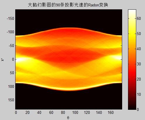 基于MATLAB的图像复原与重建设计 - 知乎