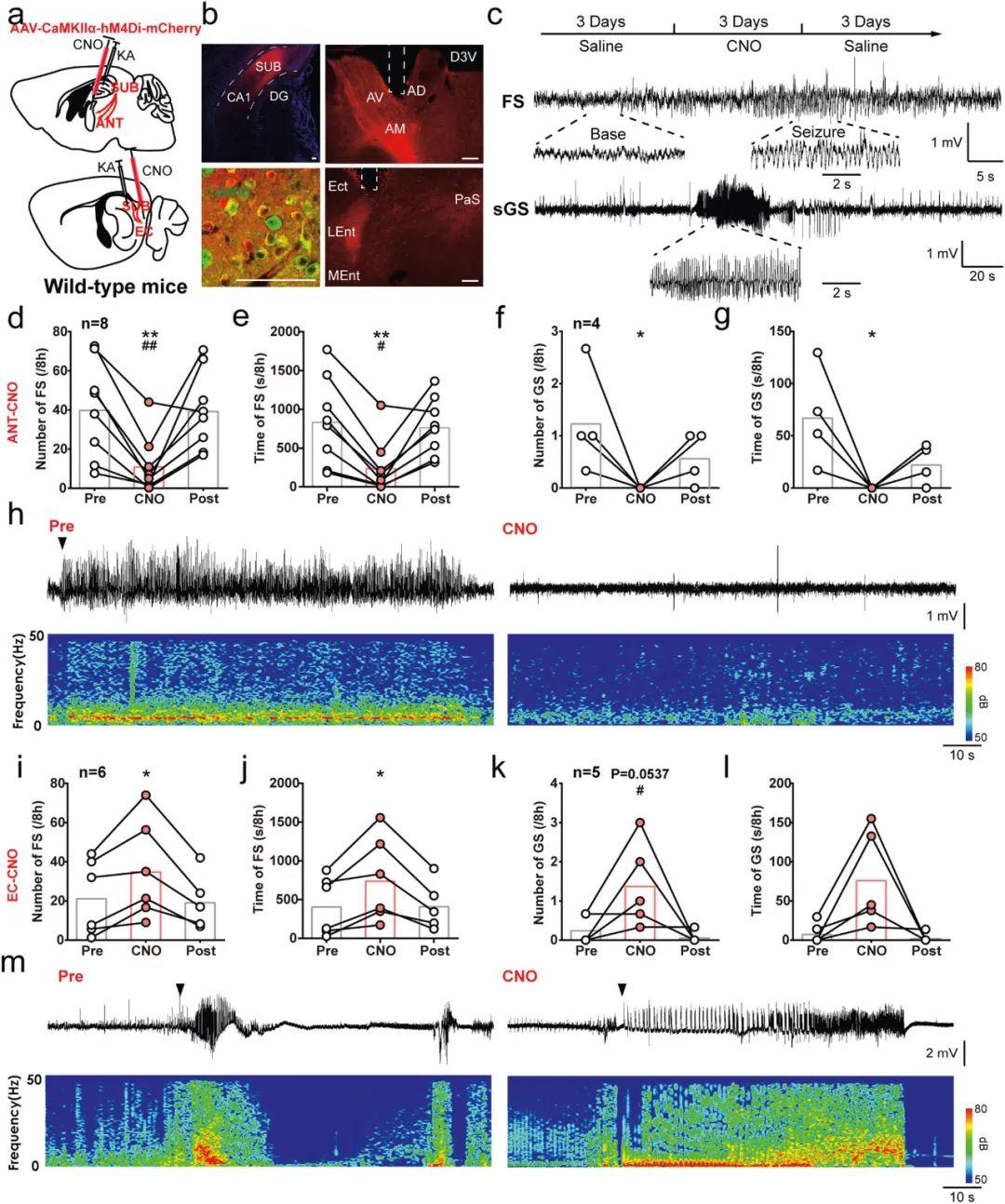Nat Commun. | 浙江中医药大学陈忠团队揭示海马下托谷氨酸能神经元在颞叶癫痫中的异质性作用 - 知乎