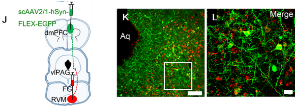 【客户文章】空军军医大学李云庆教授、董玉琳副教授团队在dmPFC-vlPAG投射神经元参与疼痛维持阈值和抗焦虑行为研究取得新进展 - 知乎