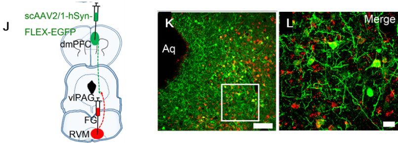 【客户文章】空军军医大学李云庆教授、董玉琳副教授团队在dmPFC-vlPAG投射神经元参与疼痛维持阈值和抗焦虑行为研究取得新进展 - 知乎