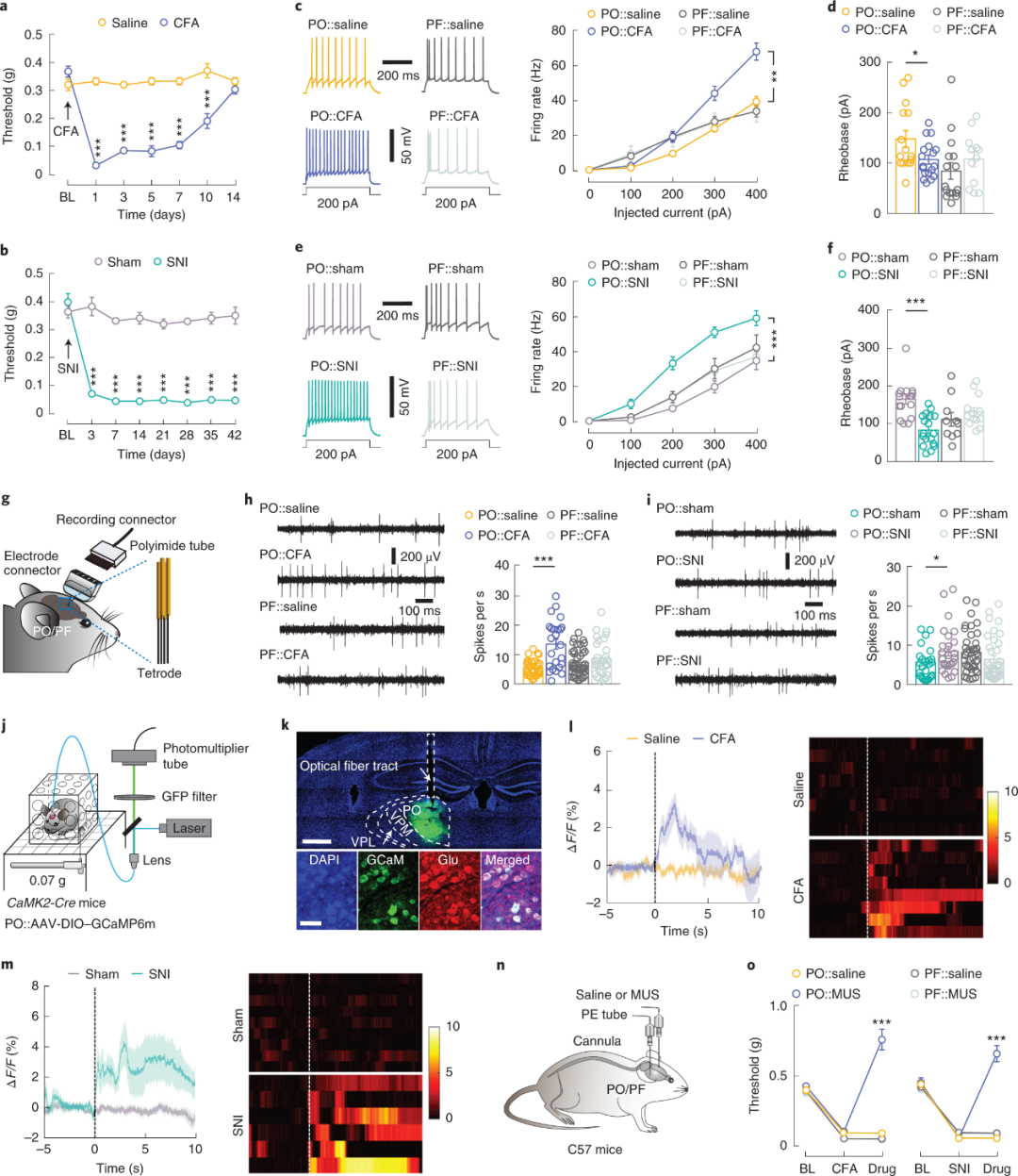 Nat Neurosci：丘脑皮层环路介导组织损伤和抑郁样状态导致的疼痛超敏 - 知乎