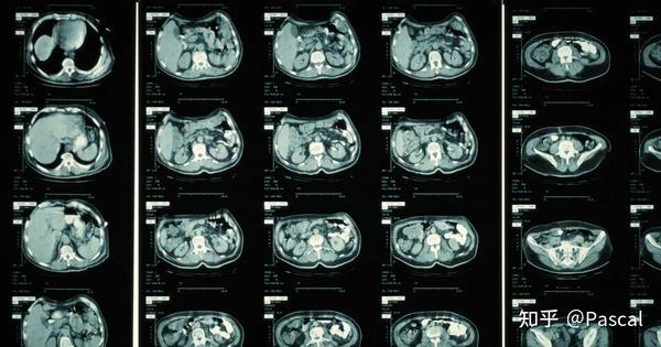 [CV - Medical 3D Image Analysis - 2021] 医学3D计算机视觉（上） - 知乎