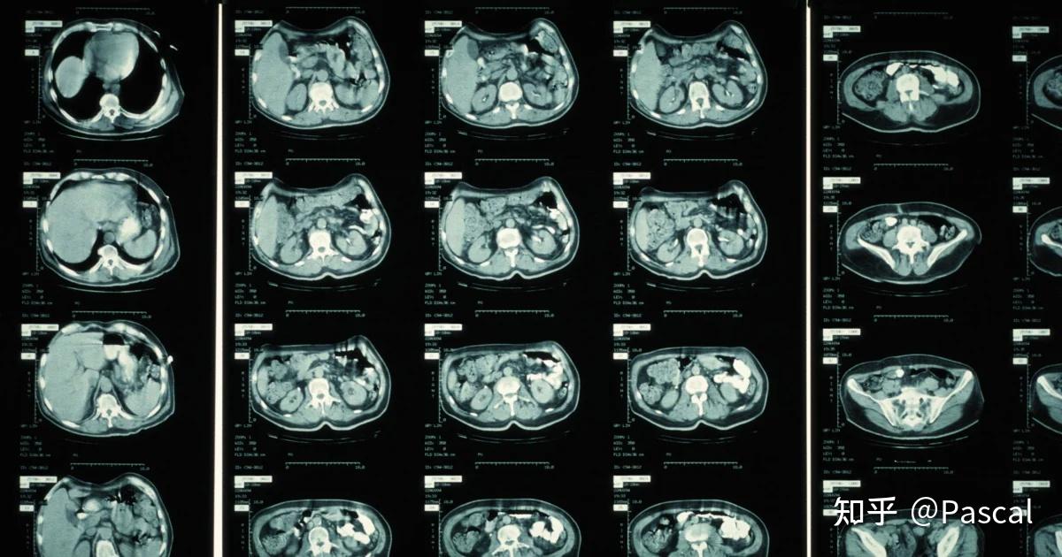 [CV - Medical 3D Image Analysis - 2021] 医学3D计算机视觉（上） - 知乎