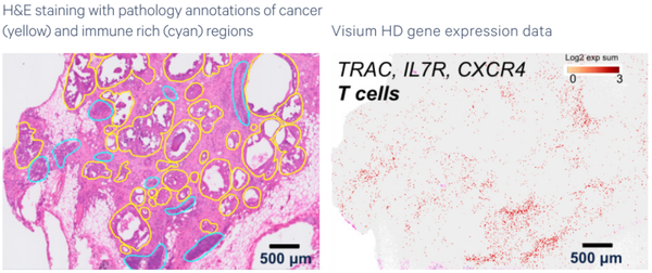 10x Visium HD 震撼来袭，开启单细胞分辨率下空间发现新时代！ - 知乎