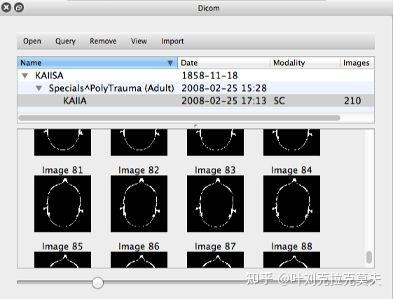 开源科学工程技术软件介绍65 – 用于图像引导治疗的研究平台CustusX - 知乎