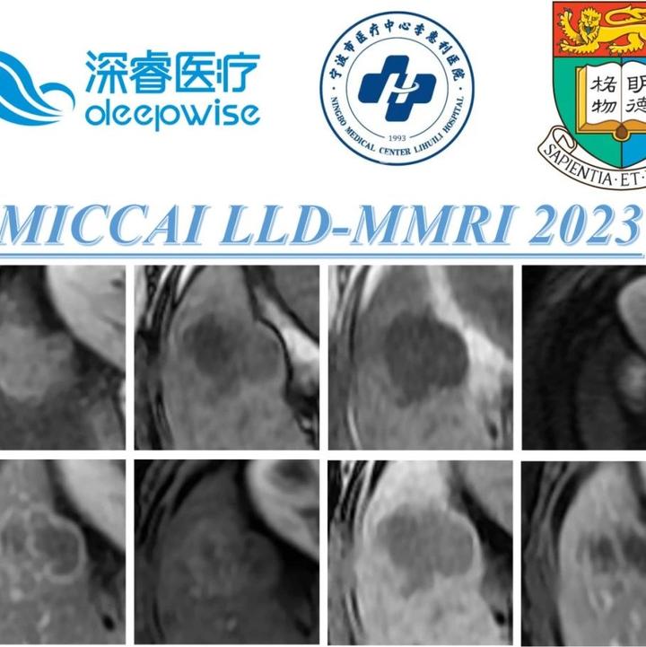 MICCAI 2023 肝脏病变诊断挑战赛 (奖金丰厚) - 知乎