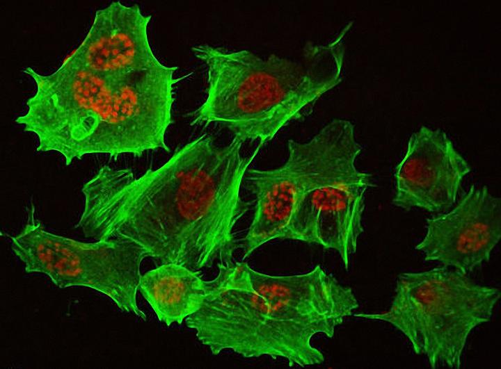 ImageJ实用技巧——平均荧光强度检测(定量分析篇) - 知乎