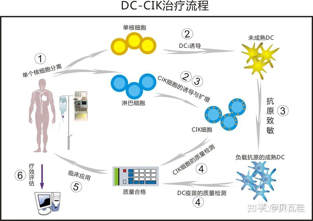 抗癌免疫细胞疗法的DC、CIK、NK、TIL、γδT...分别是什么？ 有何不同？ - 知乎