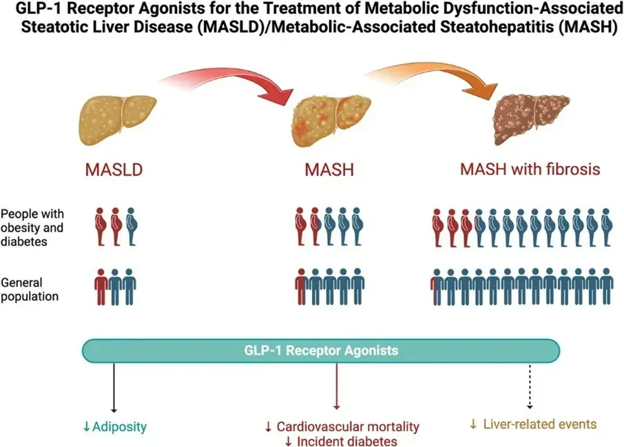 MASH治疗新探索: GLP-1RA药物在MASH治疗中的应用 - 知乎