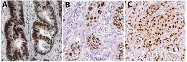 上皮细胞-间充质转化(EMT)标志物—Antibody IHC/WB Panel - 知乎
