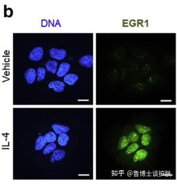 炎症因子IL-4通过EGR1调控节律系统中枢基因PER2 - 知乎