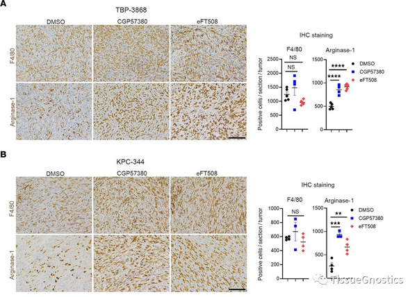 JCI Insight| 通过巨噬细胞调控CD8+T 细胞肿瘤免疫的新机制 - 知乎