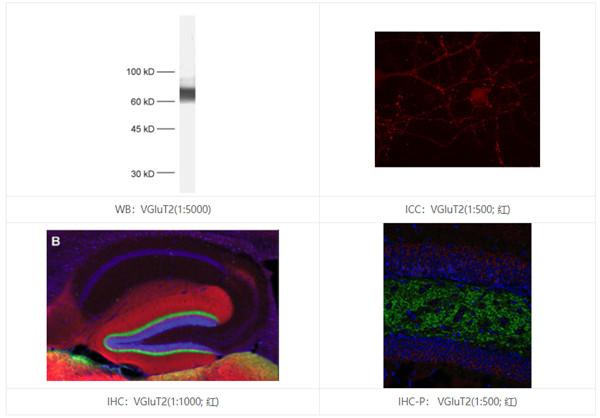 囊泡型谷氨酸转运蛋白2（VGLUT 2）——发表文章超80+&结果图展示 - 知乎
