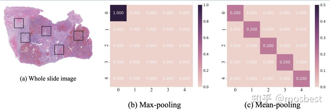 TransMIL: 基于 Correlated Multiple Instance Learning Transformer 用于 WSI ...