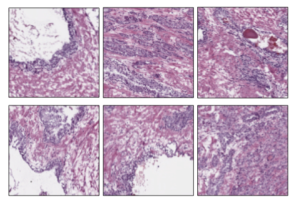 病理图像处理随笔(2)--WSI切片 - 知乎