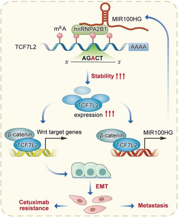 结直肠癌进展和转移机制研究新发现 - 知乎