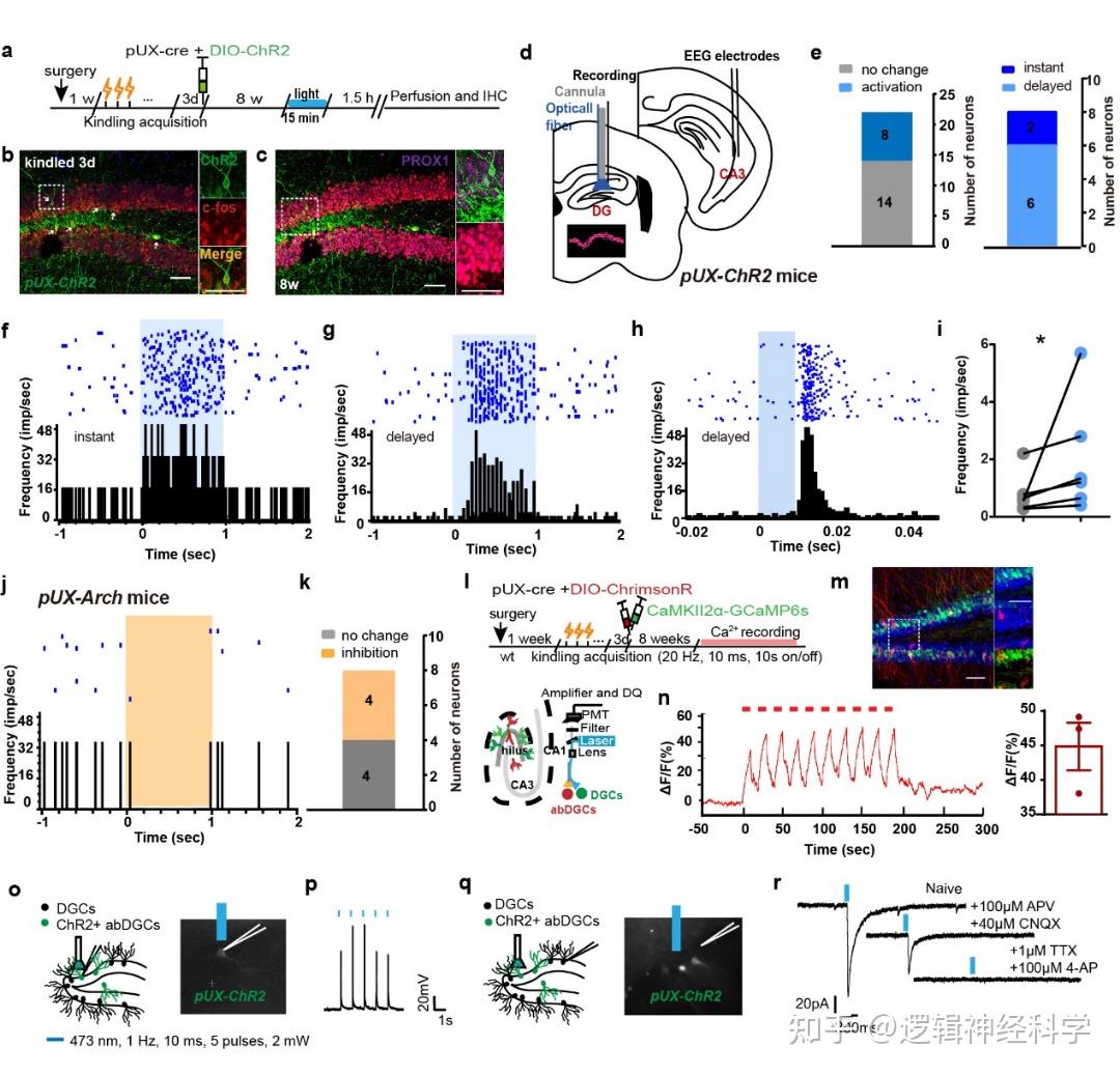 STTT︱浙江大学/浙江中医药大学陈忠/汪仪团队揭示颞叶癫痫中海马新生神经元的异质性功能及作用机制 - 知乎