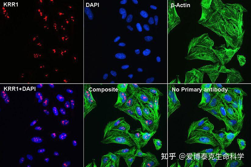 超全攻略 ！一文理清免疫荧光实验步骤、技巧及疑难问题 - 知乎