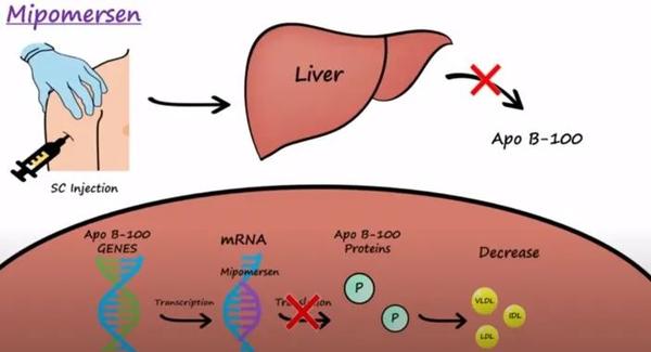 TiPLab医药专利研究：反义寡核苷酸降脂药物Kynamro® - 知乎