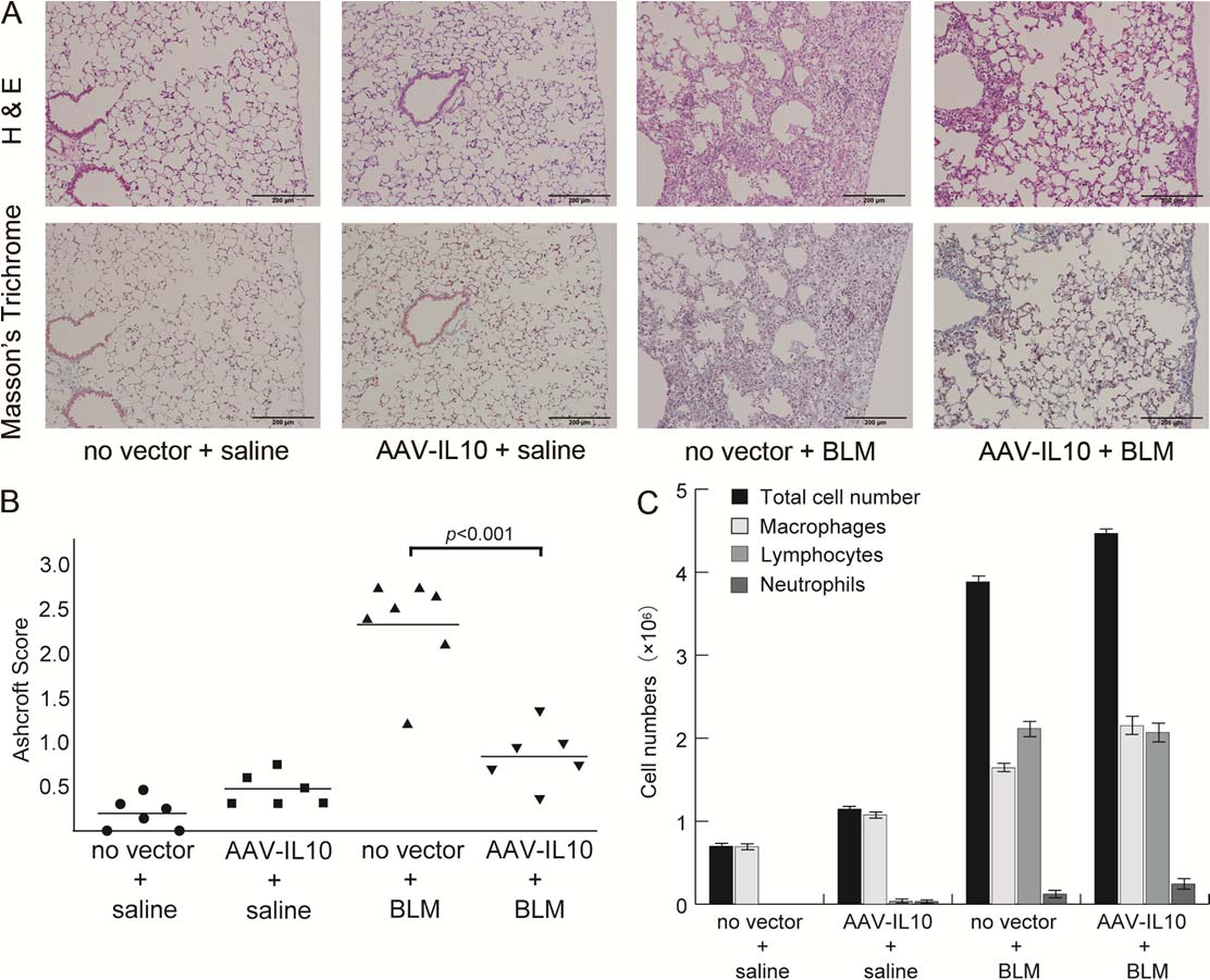 AAV感染肺部的注射方式有哪些？ - 知乎