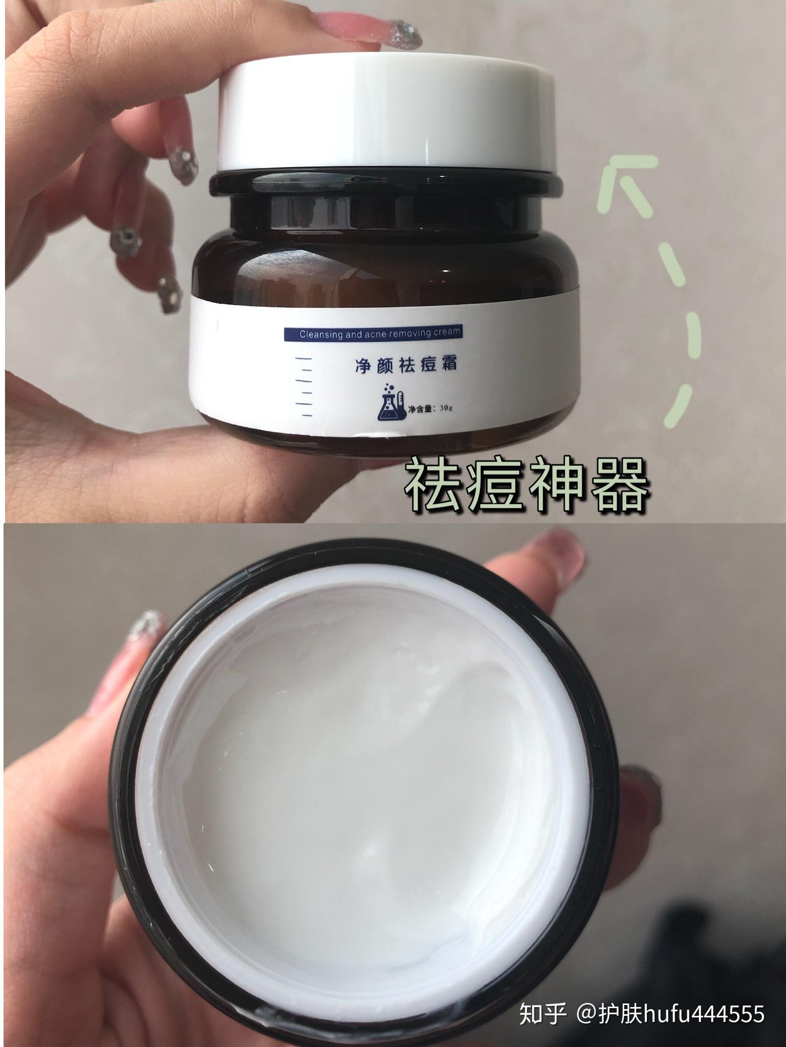 我的祛痘总结都在这里了! 知乎