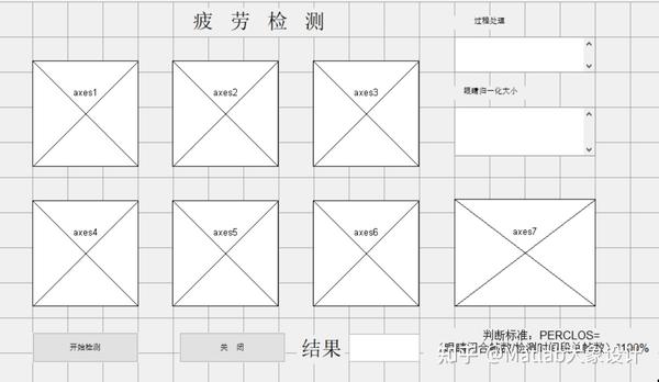 2022 2023届matlab数字图像毕设课题推荐 知乎 