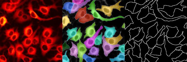 ImageJ实用教程——基于cellpose的不规则细胞分割（案例分析篇） - 知乎