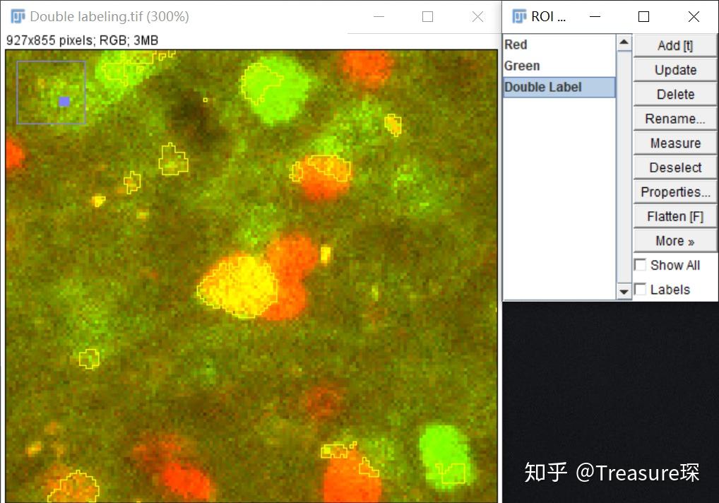 ImageJ实用技巧——荧光共标细胞计数(解放双手篇) - 知乎