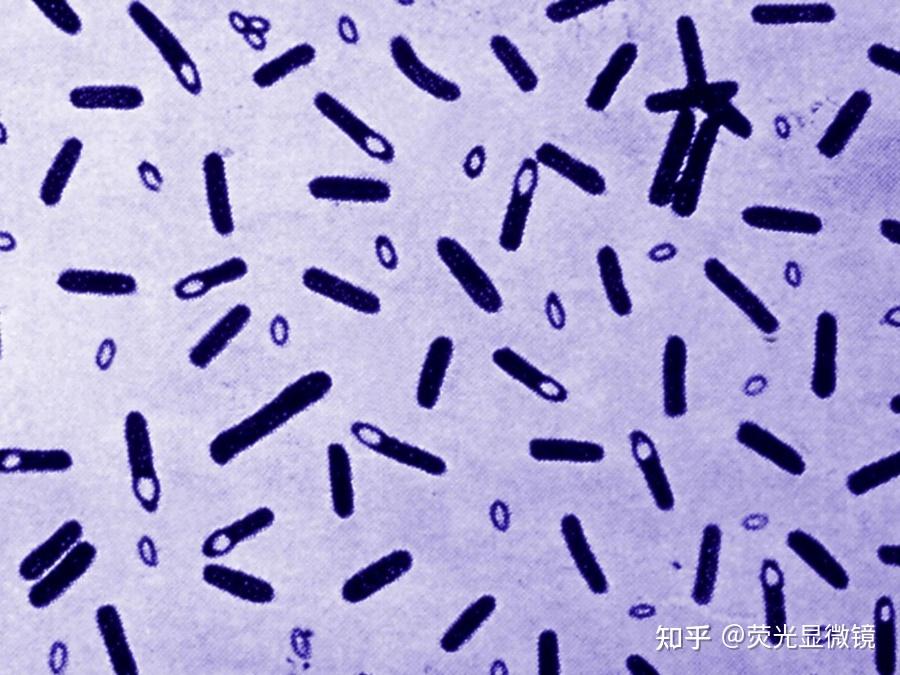 显微镜下的芽孢杆菌 - 知乎