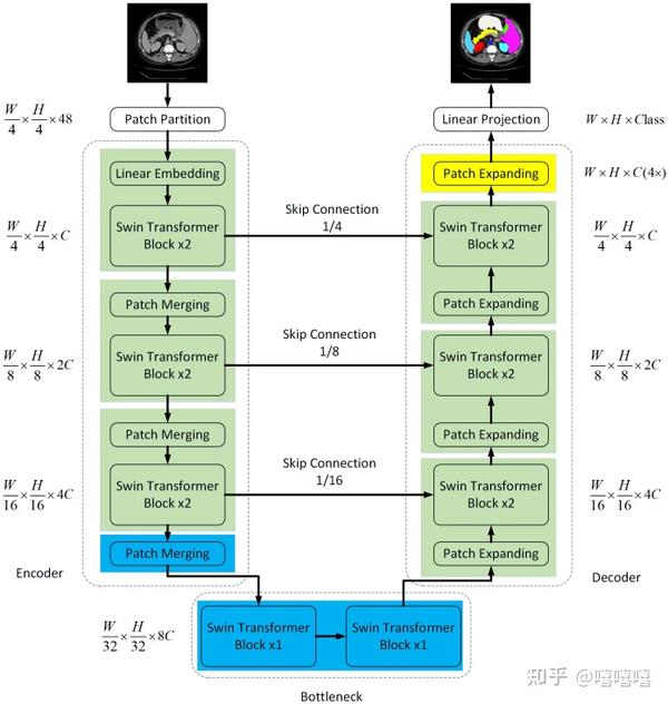 TransUNet与SwinUNet：前者更传统，后者更transformer - 知乎