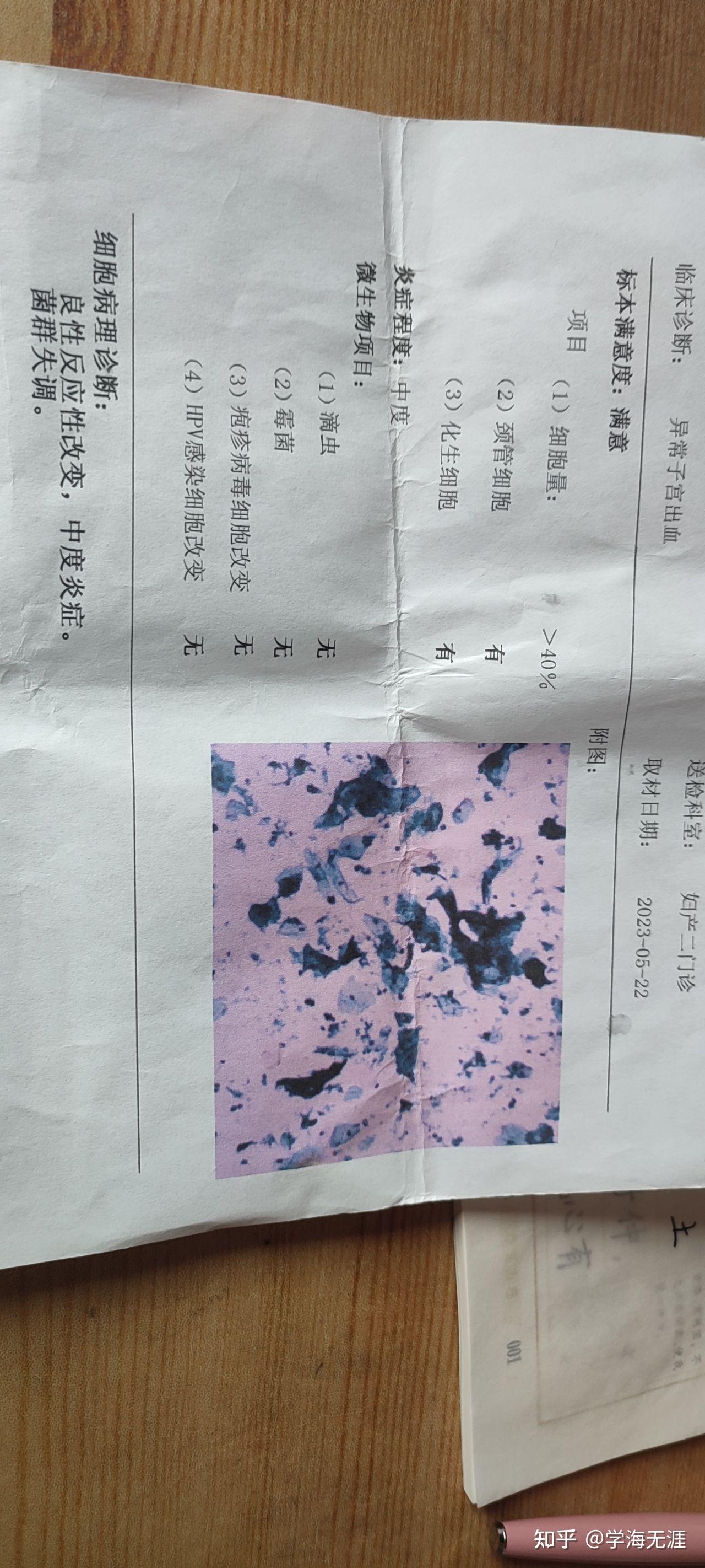 宫颈leep手术记录 - 知乎