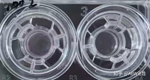 Transwell侵袭实验——熟练篇 - 知乎