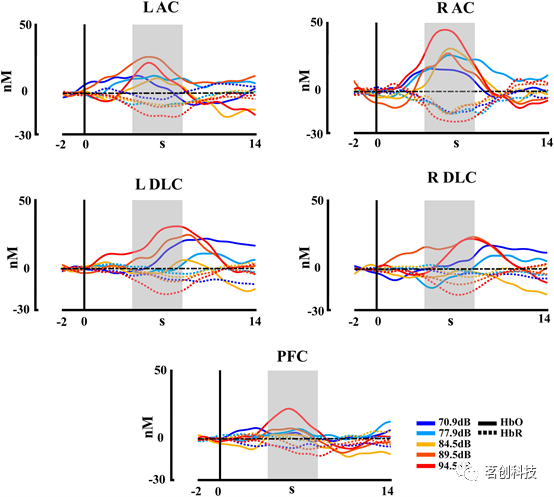 听觉刺激期间的神经血管耦合：ERPs和fNIRS血流动力学 - 知乎