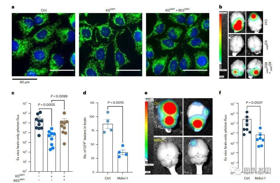 Nat Can | 线粒体脂质代谢变化可抑制乳腺癌脑转移 - 知乎